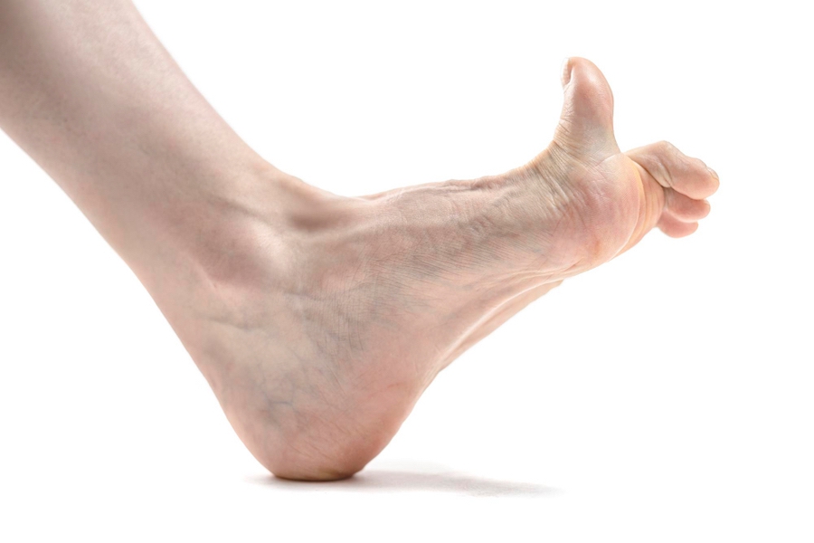 Topuk Dikeni: Nedenleri, Belirtileri ve Tedavi Yöntemleri - Kadıköy ...